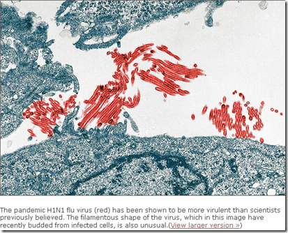 Avian Flu Diary: The Picture Of Ill Health